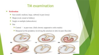 Physical examination of ear | PPTX
