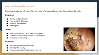 Ear Fungus vs. Bacterial Infections.pptx