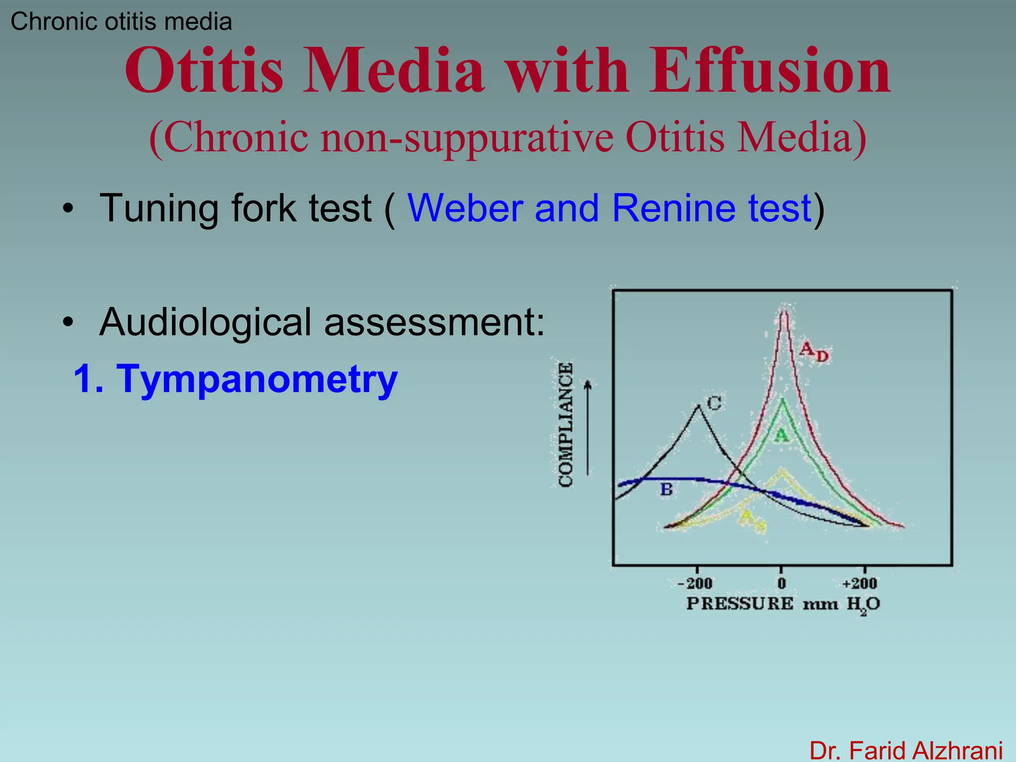 Chronic Otitis Media of Mucosal Type TT Type | PPT