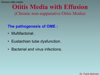 Chronic Otitis Media of Mucosal Type TT Type | PPT