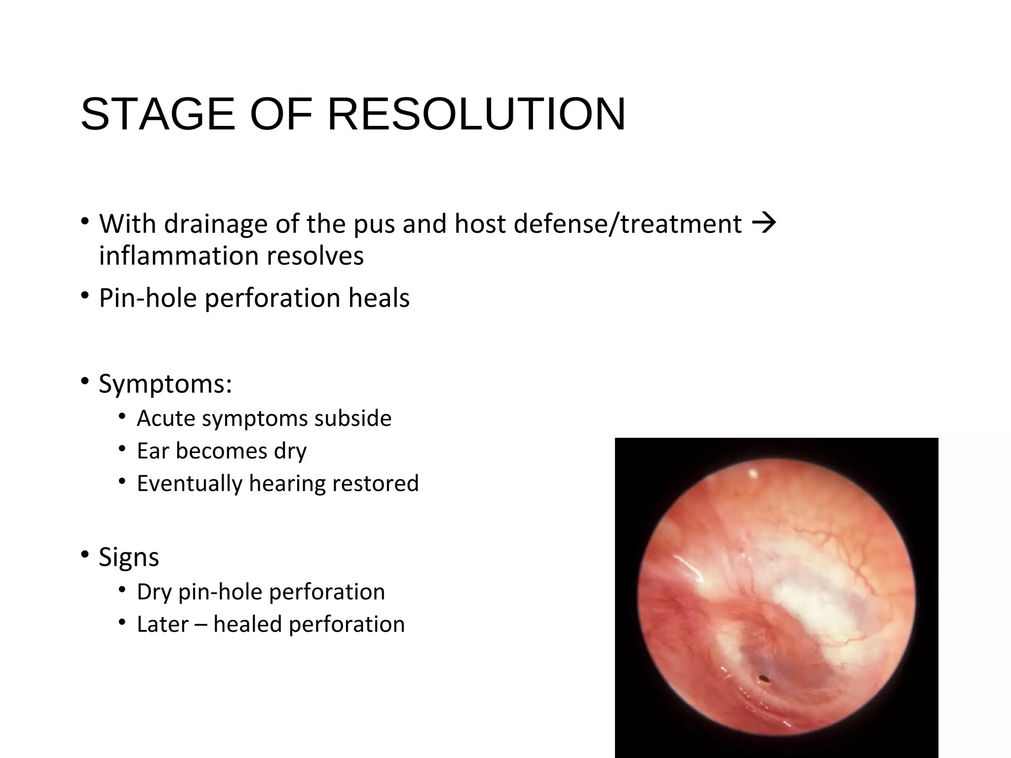 Ear infection | PPT