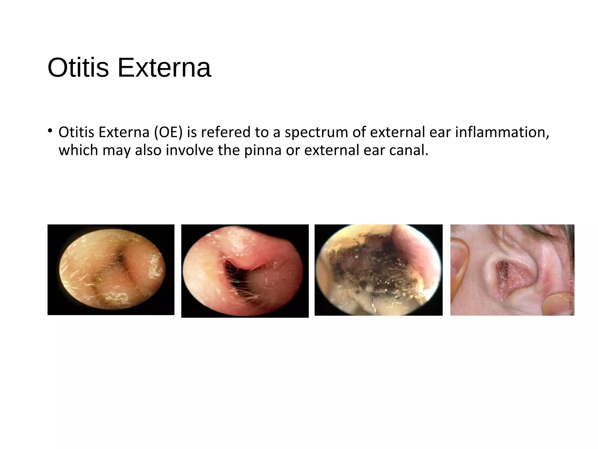 Ear infection | PPT