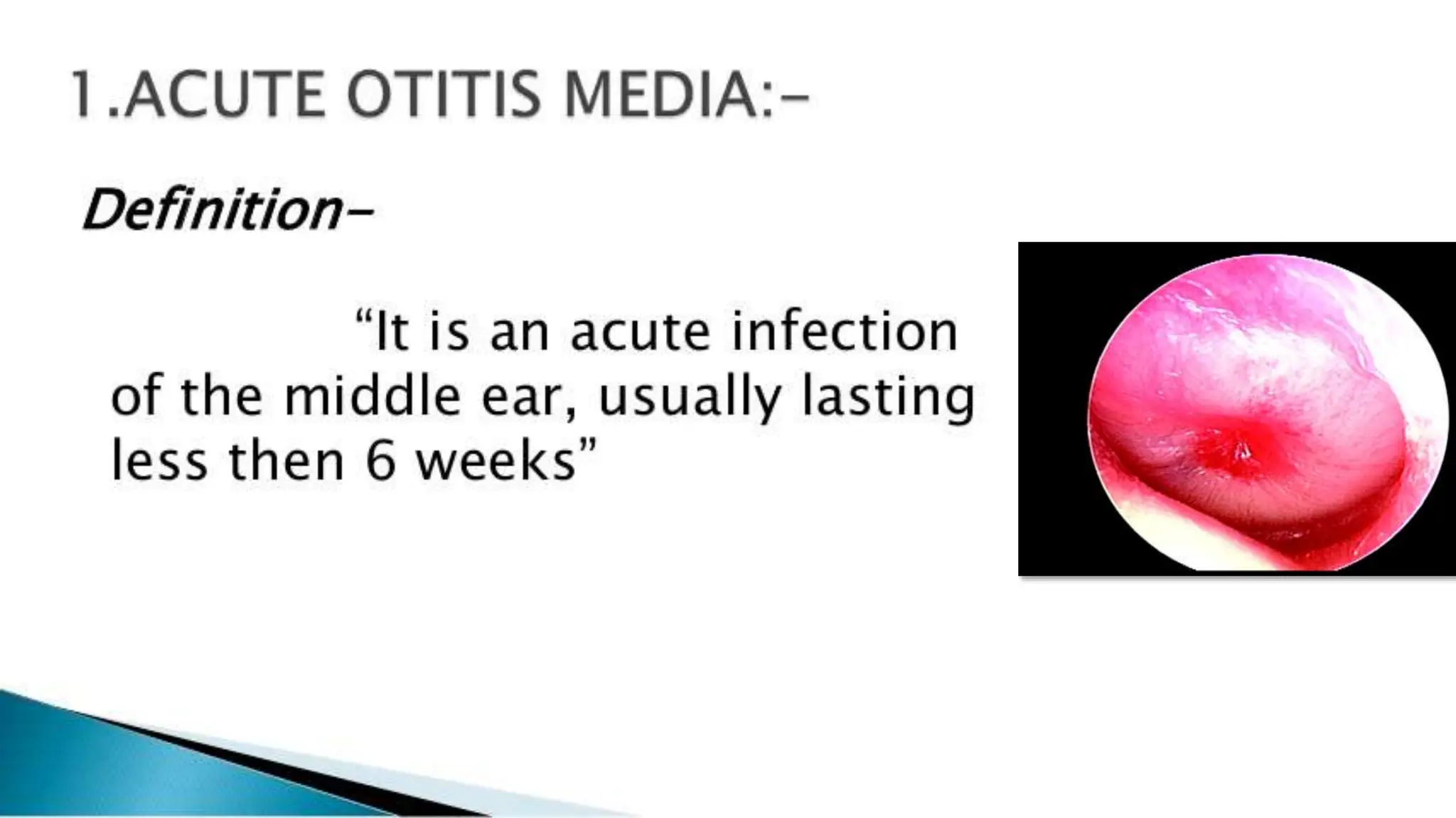 EAR INFECTIONS otitis media middle ear infection.pptx