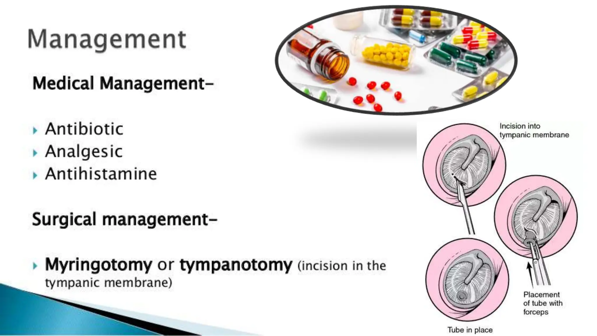 Ear Infections Otitis Media Middle Ear Infection Pptx