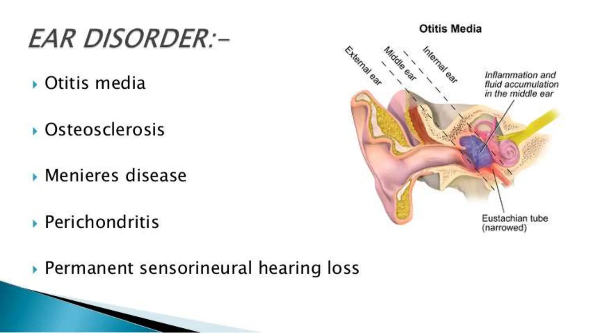 EAR INFECTIONS otitis media middle ear infection.pptx