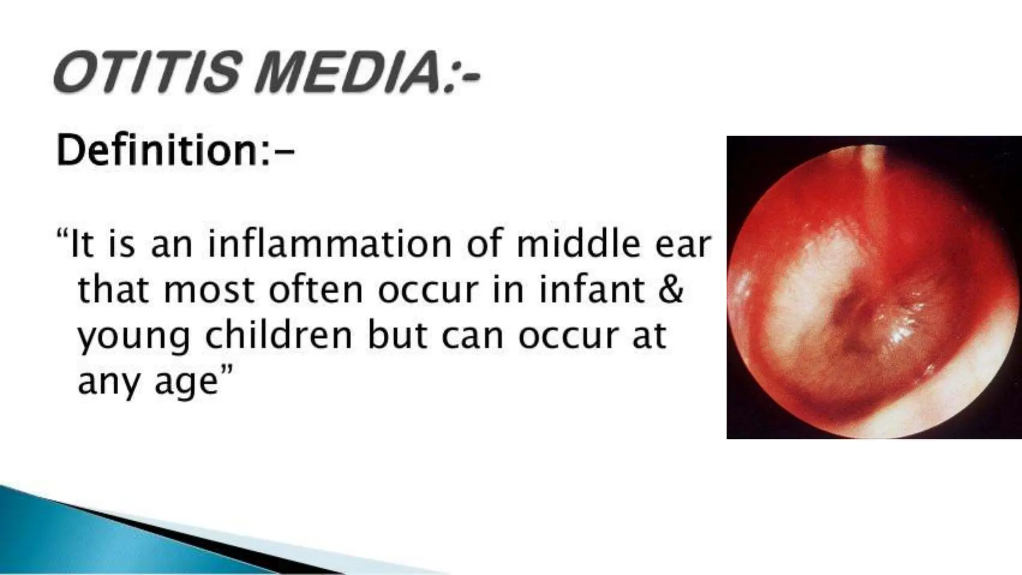 EAR INFECTIONS otitis media middle ear infection.pptx