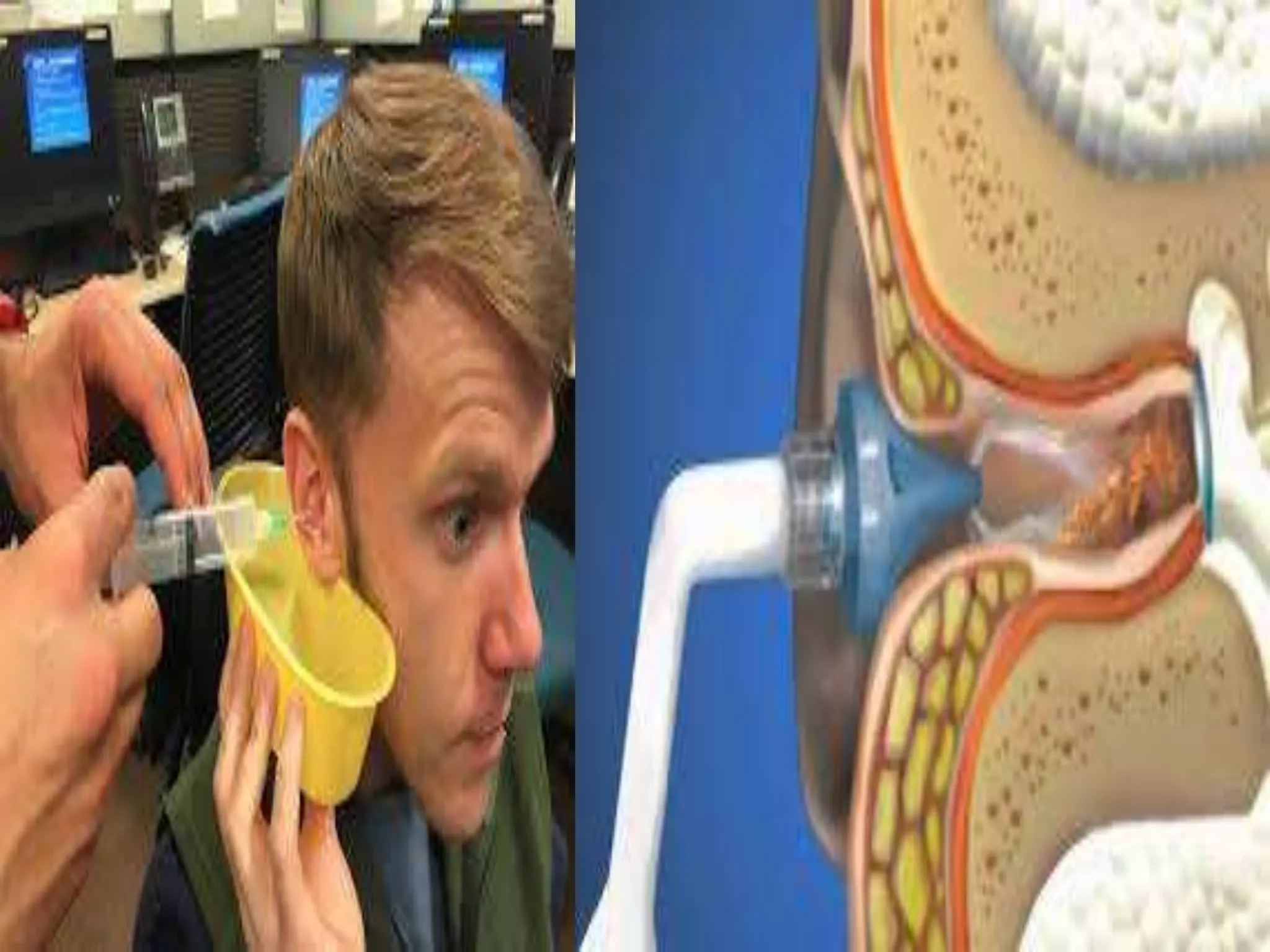 EAR IRRIGATION .pptx