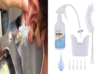 EAR IRRIGATION .pptx
