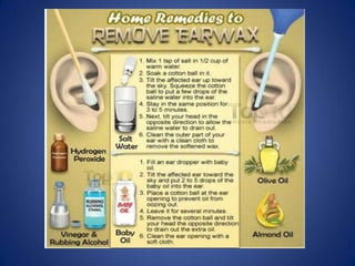 ear Irrigation.pptx