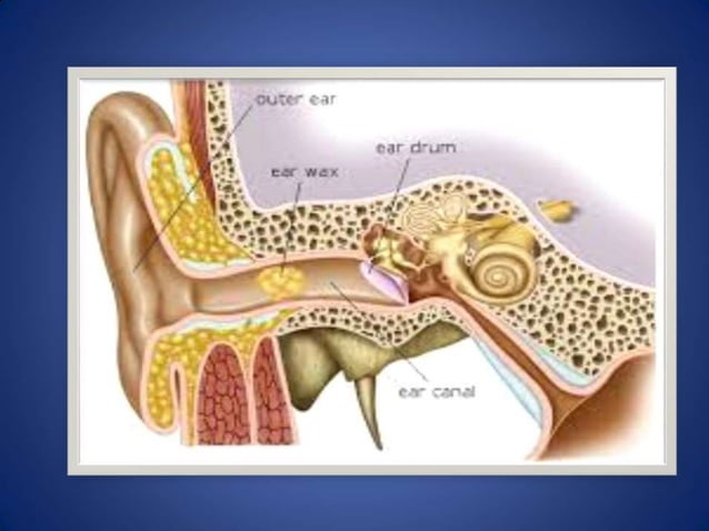ear Irrigation.pptx