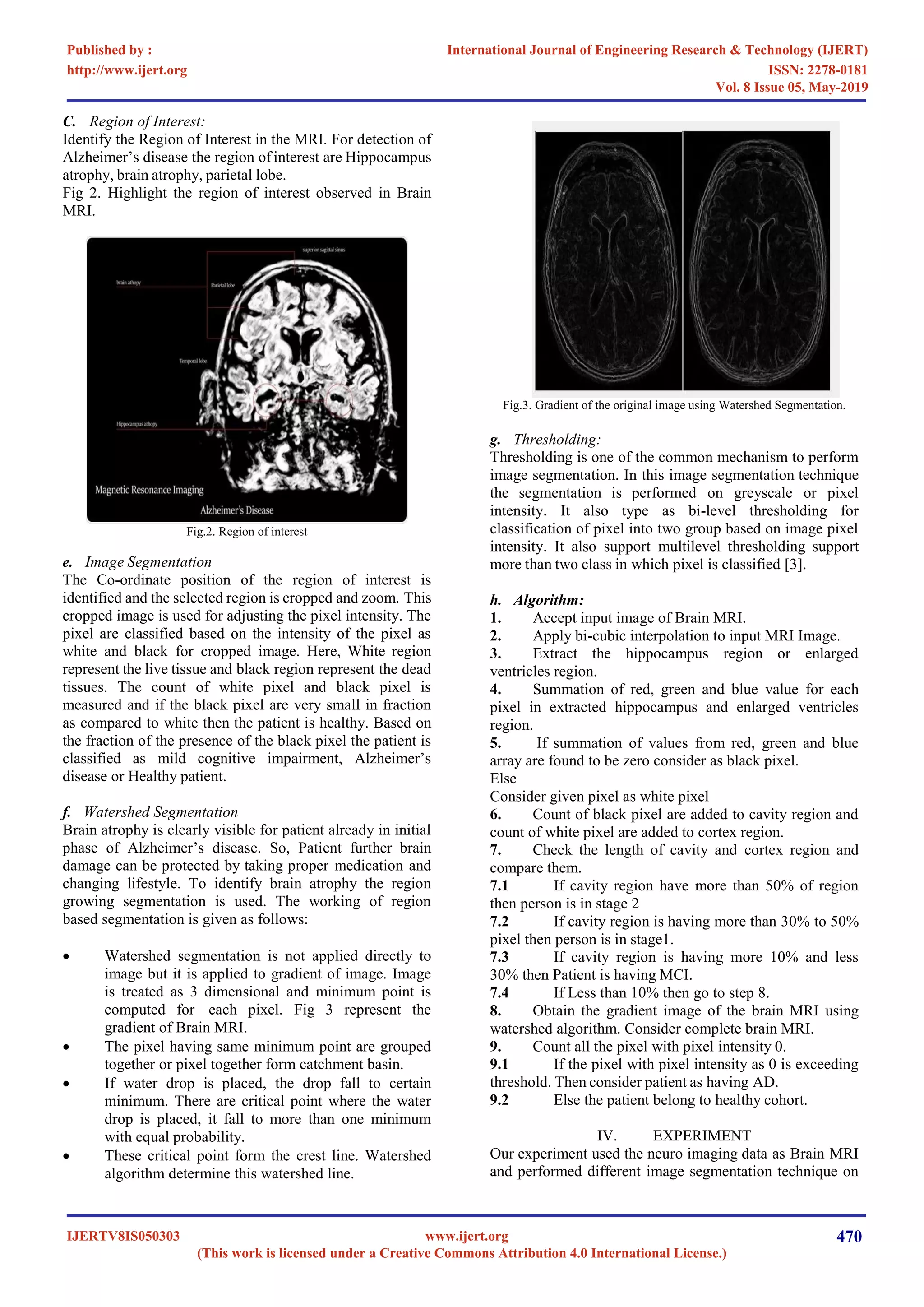 Early Detection Of Alzheimers Disease Using Image Processing Ijertv8 Is050303 Pdf