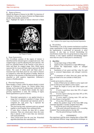 Early detection-of-alzheimers-disease-using-image-processing-ijertv8 is050303 | PDF | Brain and ...