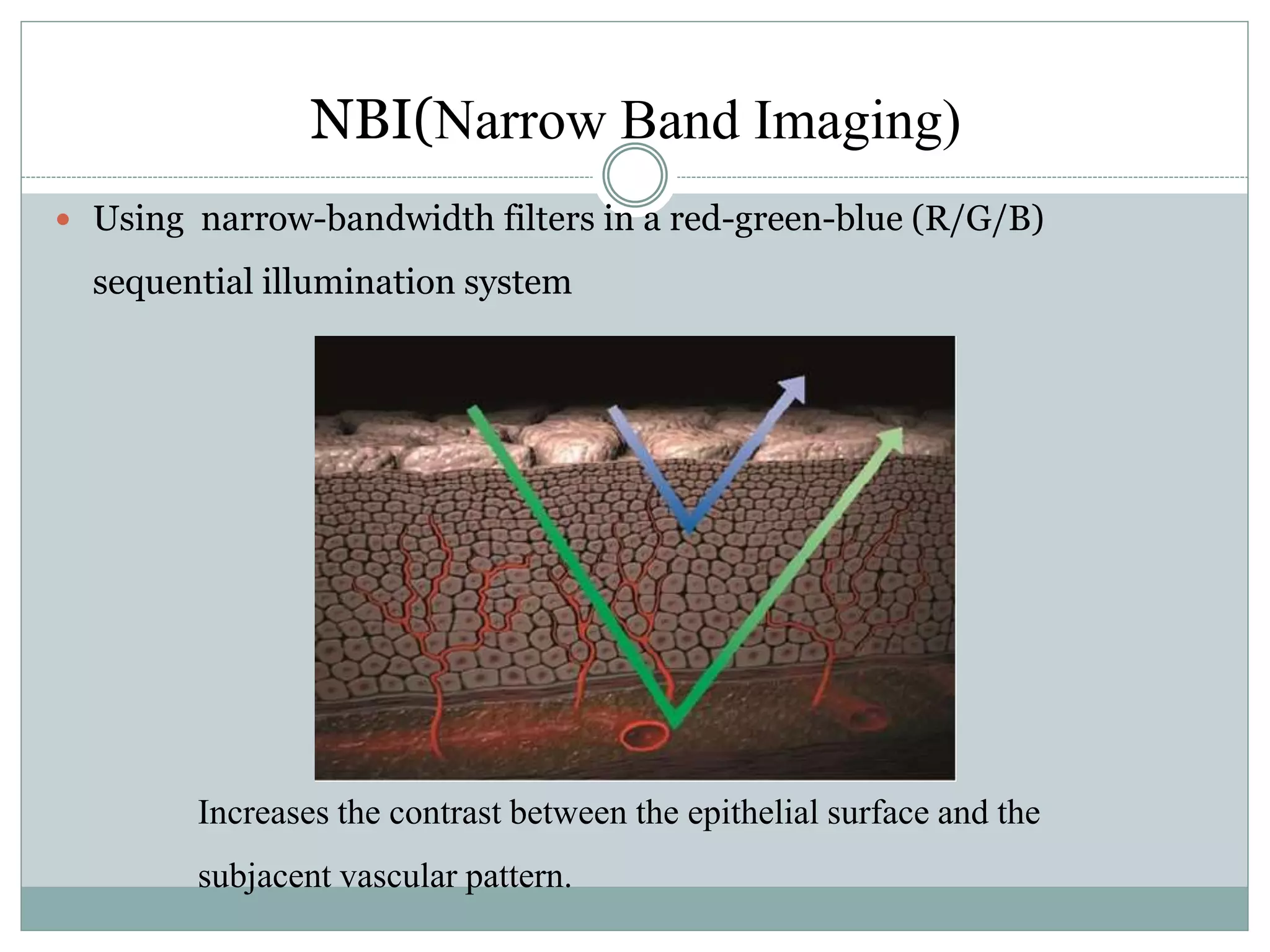 Early gastric cancer | PPTX