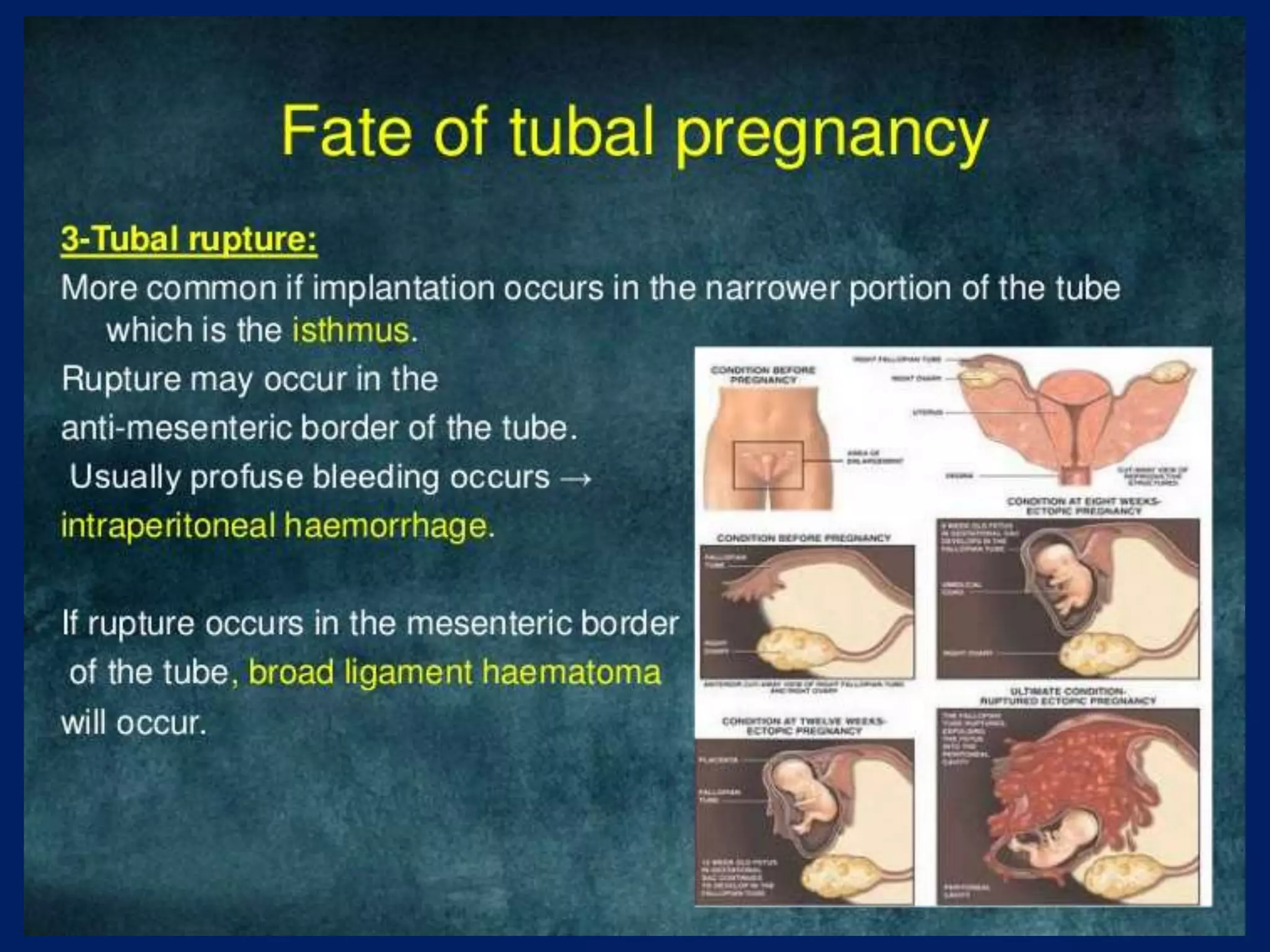 Bleeding in early pregnancy | PPTX