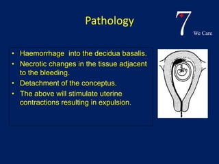 Bleeding in early pregnancy | PPTX