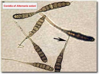 Early blight of potato | PPT