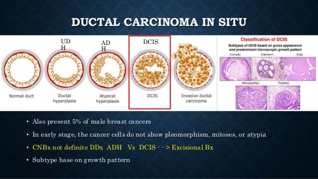 Early breast cancer management