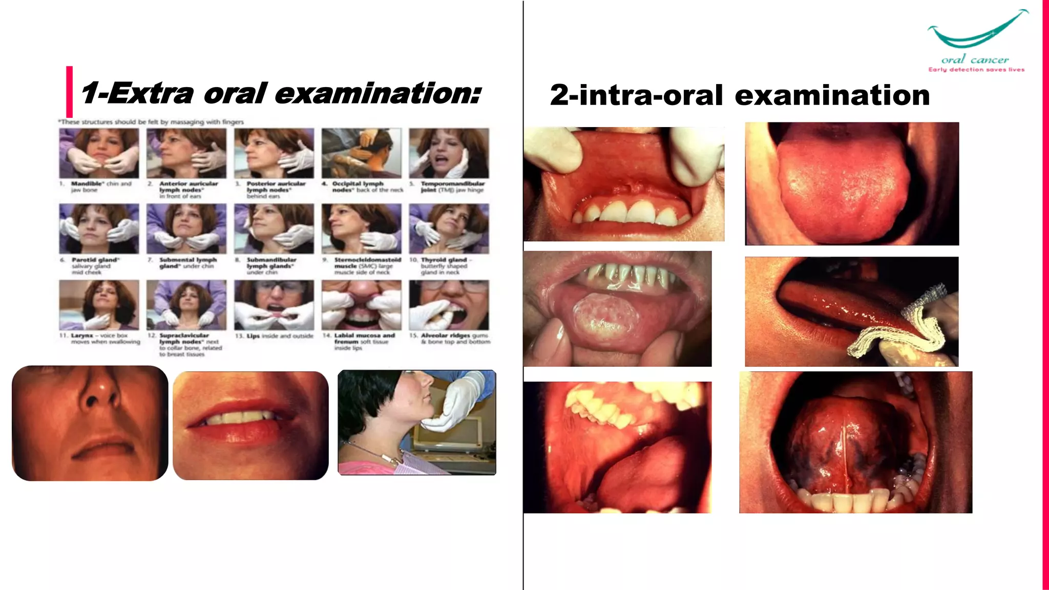 Early Cancer Detection Oral Cancer Pdf