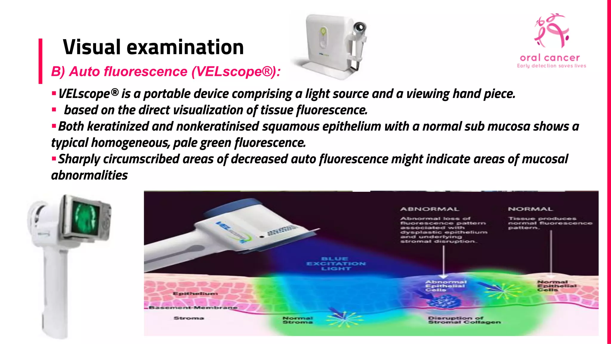 Early cancer detection ( oral cancer ) | PDF