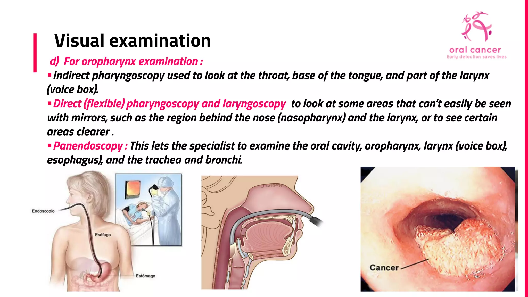 Early cancer detection ( oral cancer ) | PDF | Dental Health | Diseases and Conditions