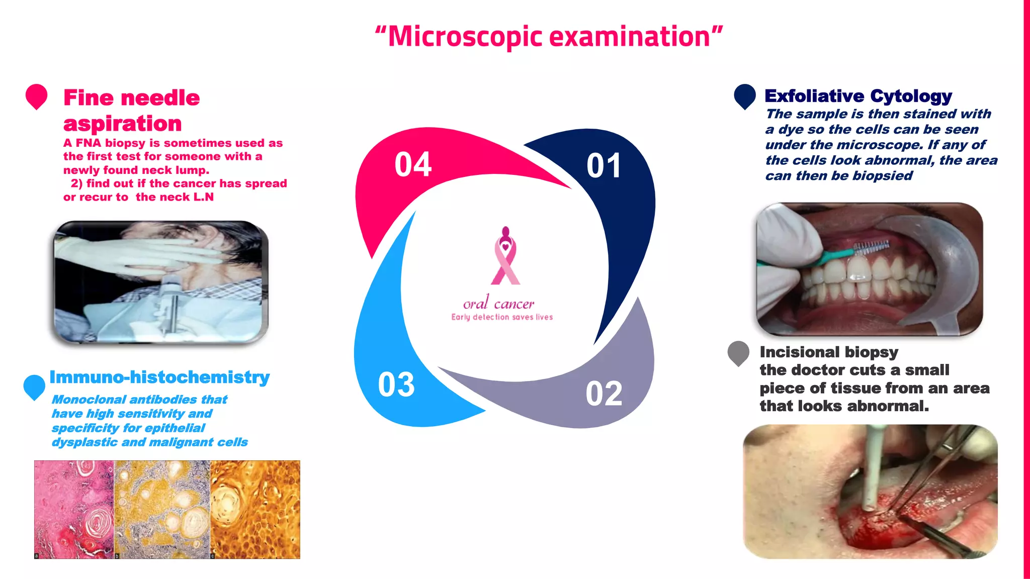 Early cancer detection ( oral cancer ) | PDF | Dental Health | Diseases and Conditions