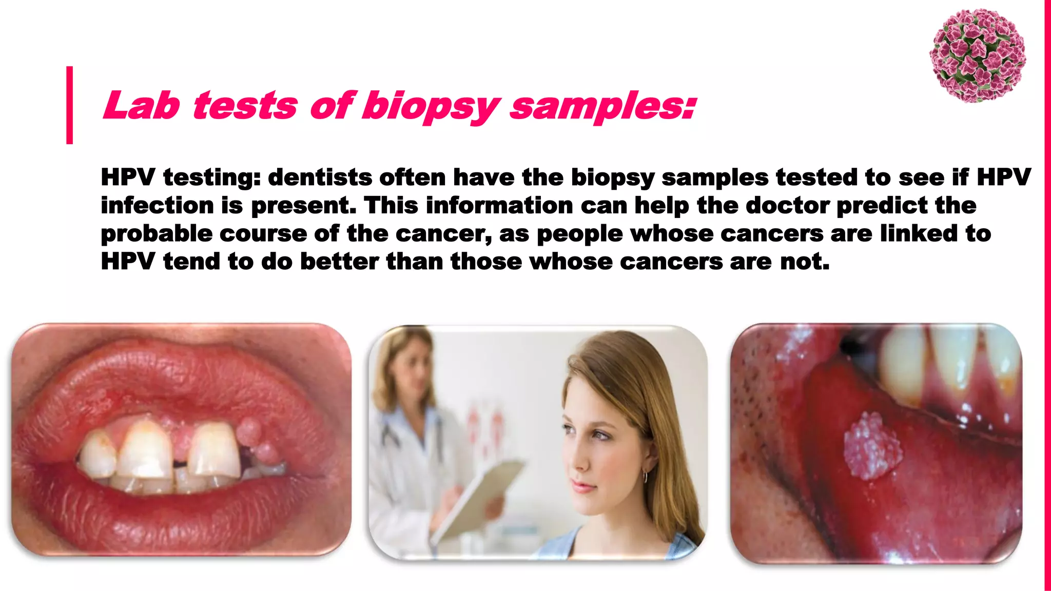 Early cancer detection ( oral cancer ) | PDF | Dental Health | Diseases and Conditions