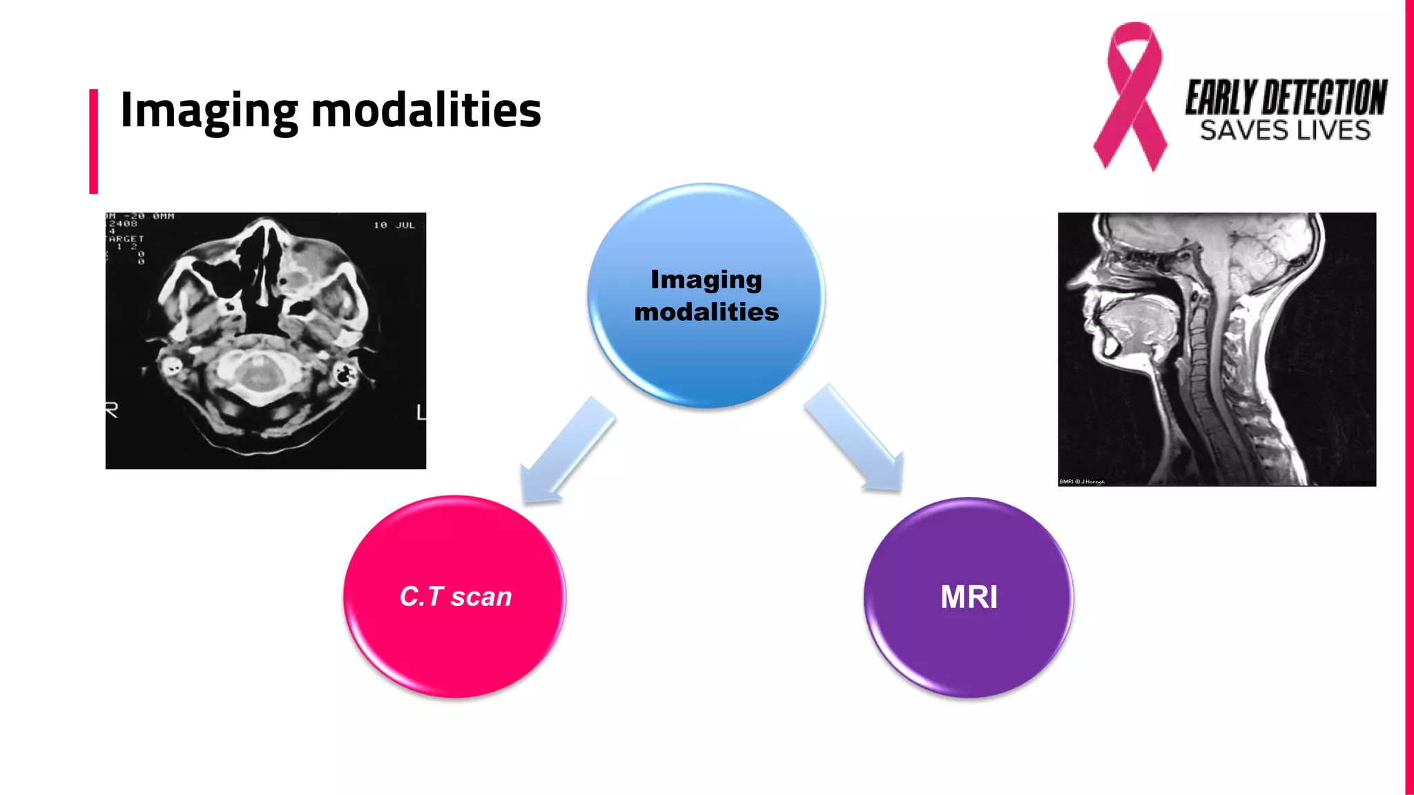 Early cancer detection ( oral cancer ) | PDF | Dental Health | Diseases and Conditions