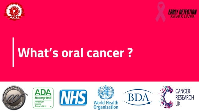 Early cancer detection ( oral cancer ) | PDF | Dental Health | Diseases ...