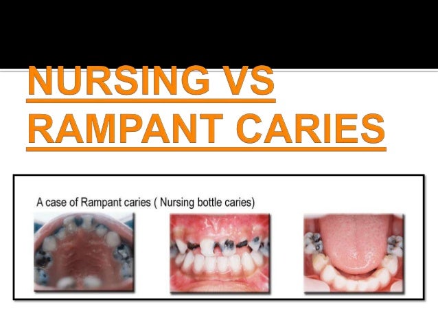 Early childhood caries