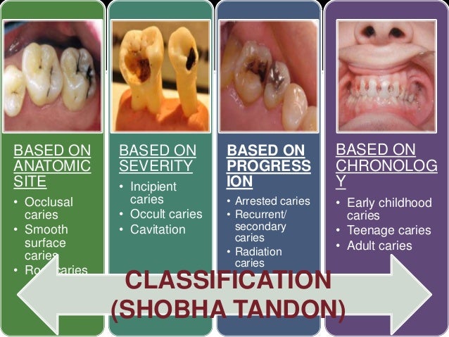 Early childhood caries
