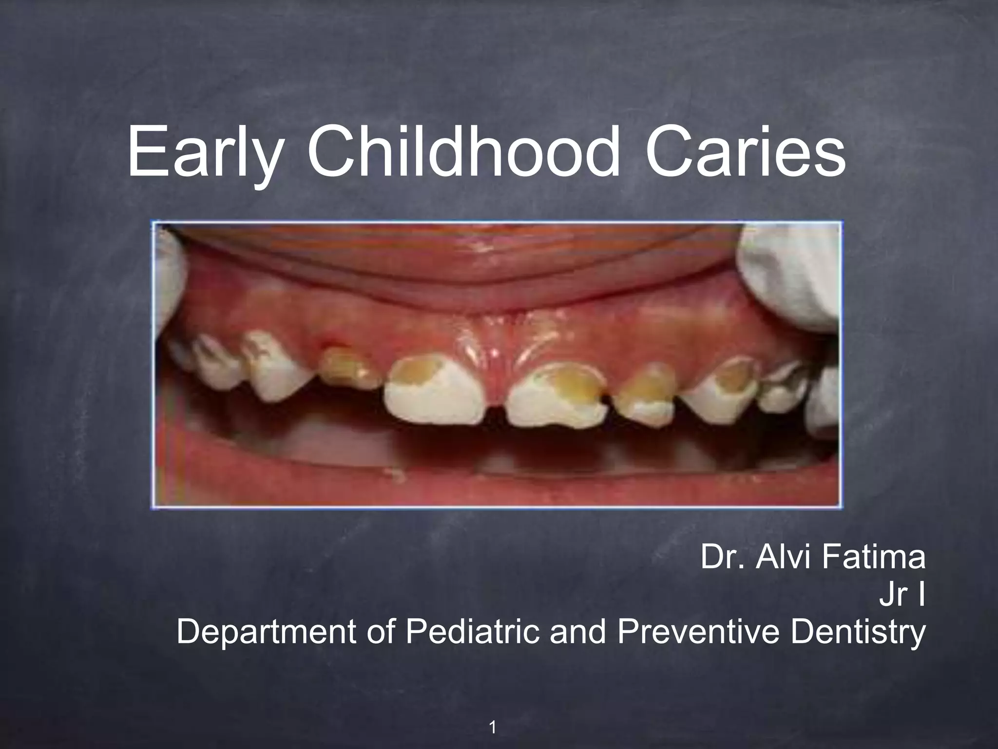 Early Childhood Caries Ppt Early Childhood Caries Pediatric