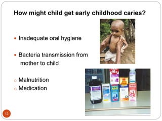 Early childhood caries.ppt