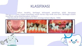 early Childhood Caries fix karies gigi.pptx