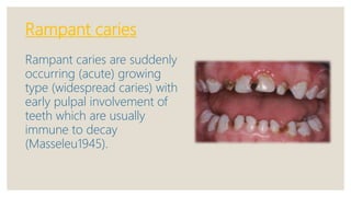 Early childhood caries, rampant, chronic and arrested caries | PPTX