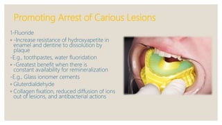 Early childhood caries, rampant, chronic and arrested caries | PPTX