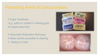 Early childhood caries, rampant, chronic and arrested caries | PPTX