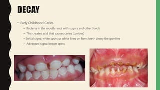 Early Childhood Presentation | PPTX