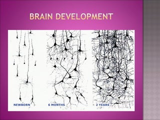 Early Childhood Trauma and Brain Development | PPT