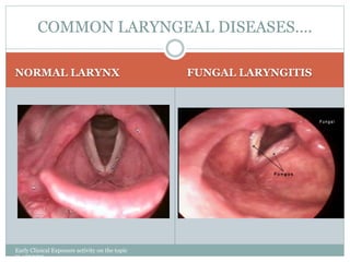 EARLY CLINICAL EXPOSURE ACTIVITY ON THE TOPIC LARYNX.pptx