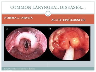 EARLY CLINICAL EXPOSURE ACTIVITY ON THE TOPIC LARYNX.pptx
