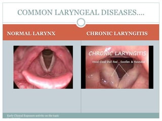 EARLY CLINICAL EXPOSURE ACTIVITY ON THE TOPIC LARYNX.pptx