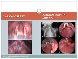 EARLY CLINICAL EXPOSURE ACTIVITY ON THE TOPIC LARYNX.pptx