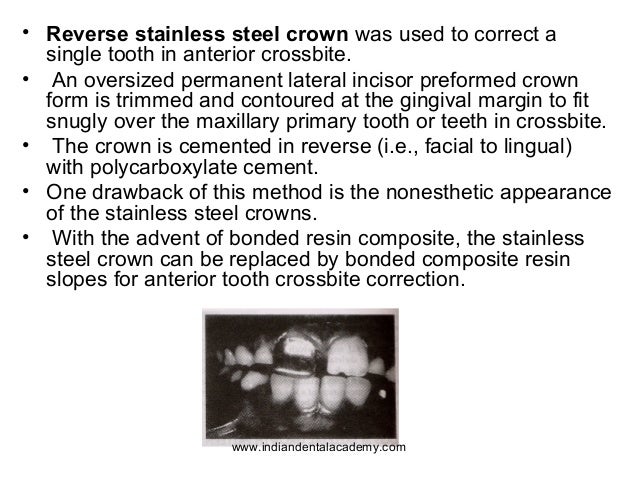 Early correction of class 3