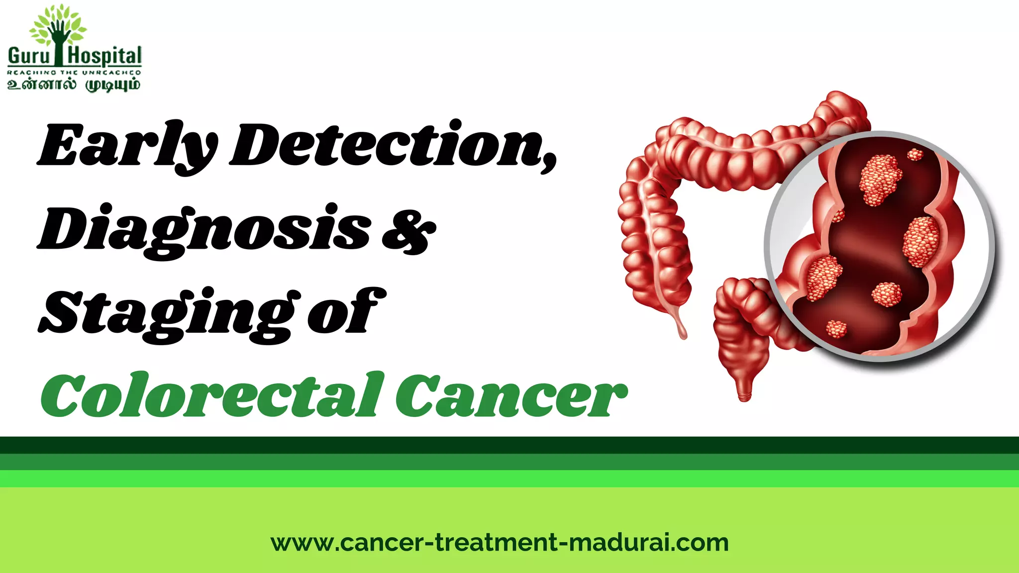 Early detection, diagnosis & staging of colorectal cancer | PDF