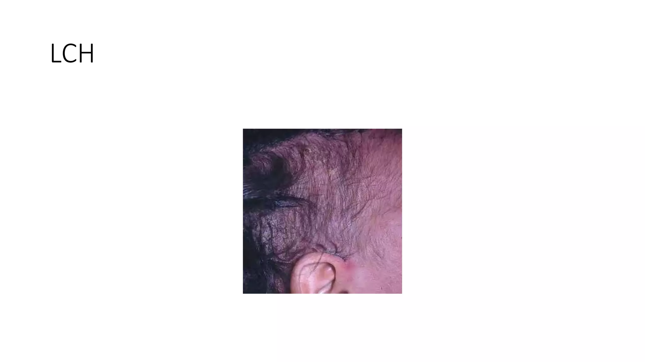 Early diagnosis of cancer in neonate and young Infant | PPTX