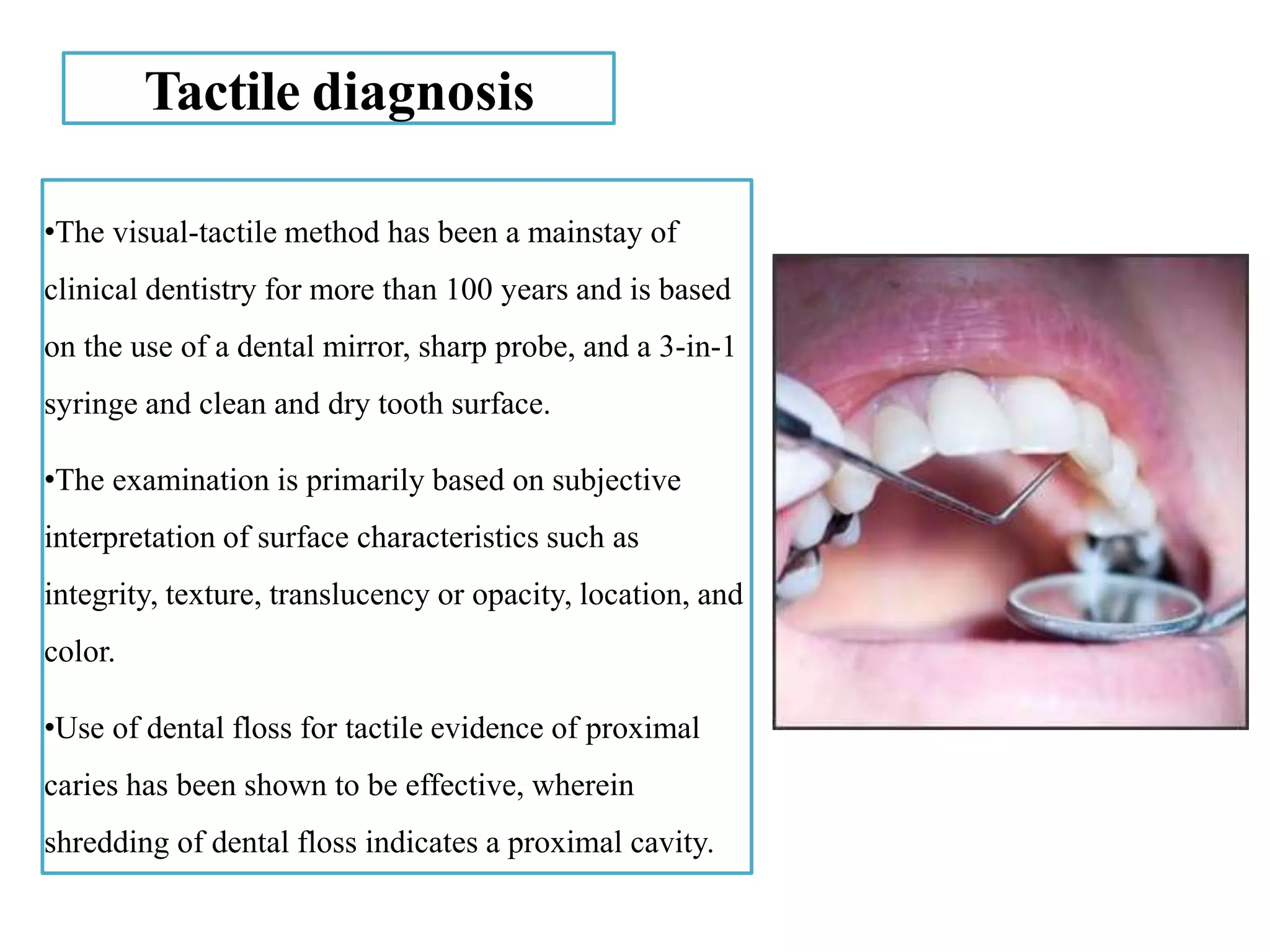 Early diagnosis of caries | PPTX