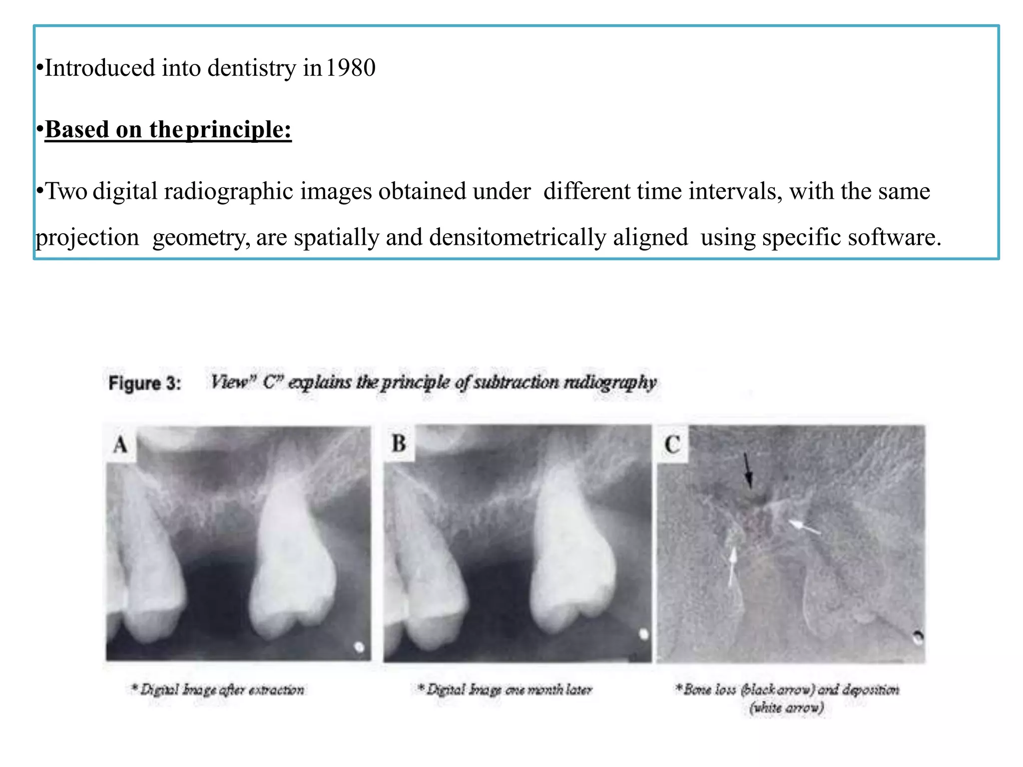 Early diagnosis of caries | PPTX