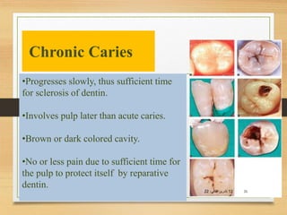 Early diagnosis of dental caries.ppt