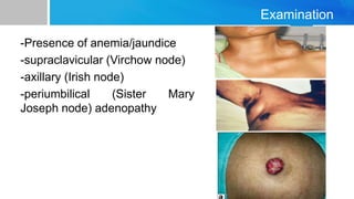 Early Diagnosis Of Gastric Carcinoma | PPTX
