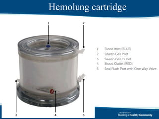 Early experience of low flow extracorporeal carbon dioxide removal in ...
